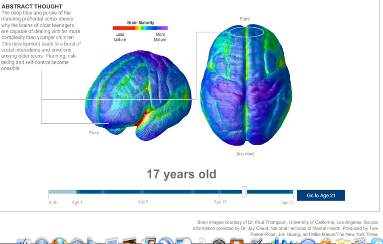 The Growth and Development of a Teenager’s Brain